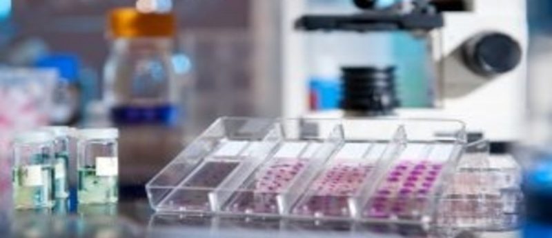 New method for screening potential anticancer compounds for breast ...