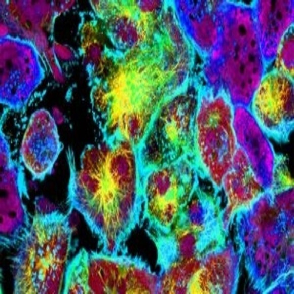 How do some tumors avoid immune destruction? Novel mechanism uncovered ...