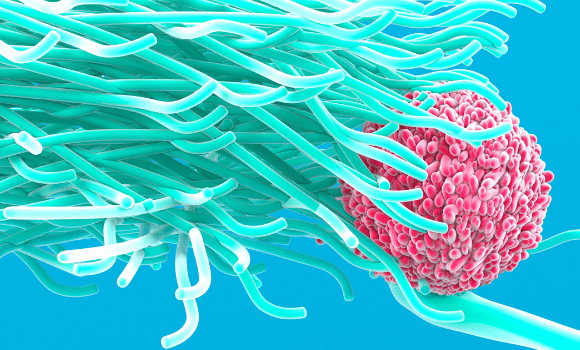 Spotlight on interventional oncology - Oncology Central