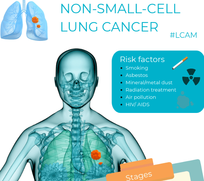 Infographics - Oncology Central Oncology Central