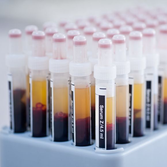 Spotlight survey on liquid biopsies - Oncology Central