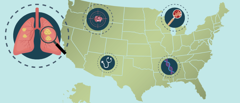 SBI Planning Tool: tackling lung cancer mortality rates in the USA ...