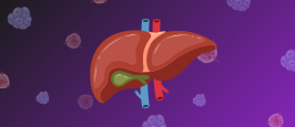 Ablative therapy improves overall survival for 'supermassive' bile duct ...
